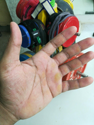 Deadlift Calluses: How to Deal With Them